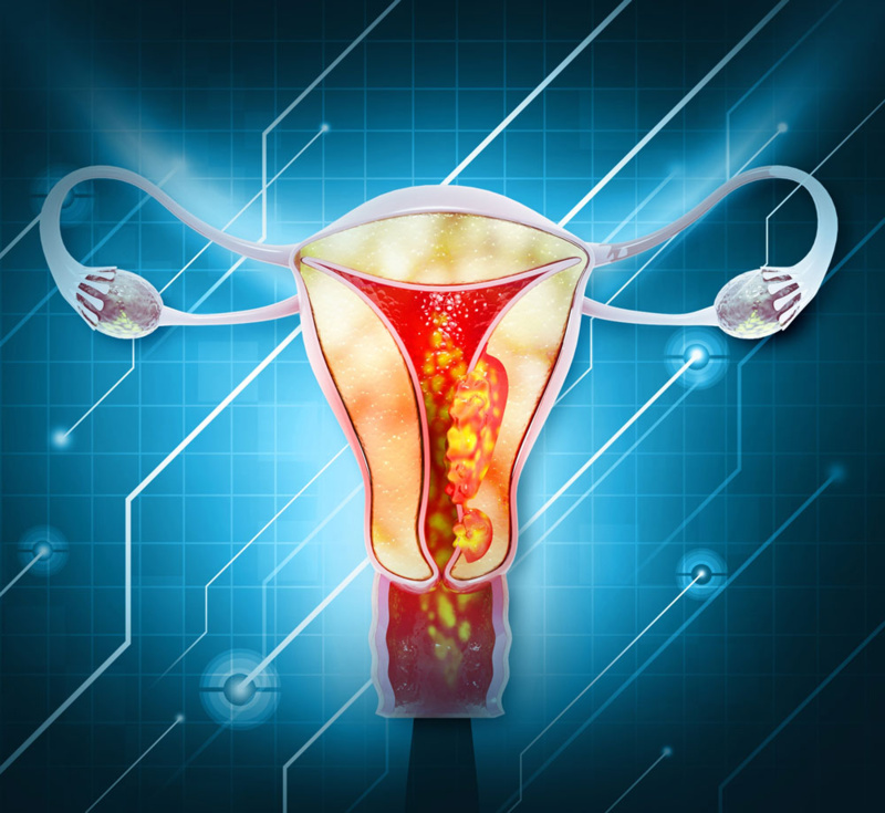 WID®-easy - Neuheiten und Innovationen - Analysen | labor team